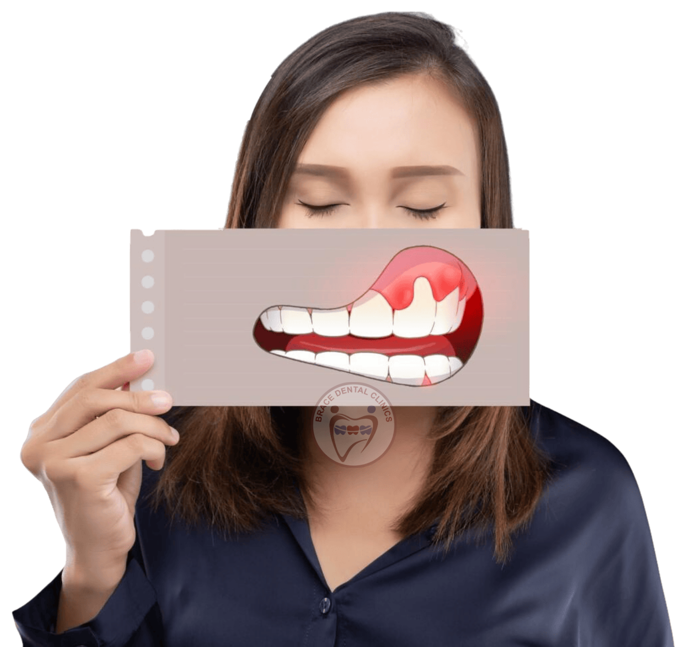 Bleeding Gums - Brace Dental Bleeding Gums - Brace Dental