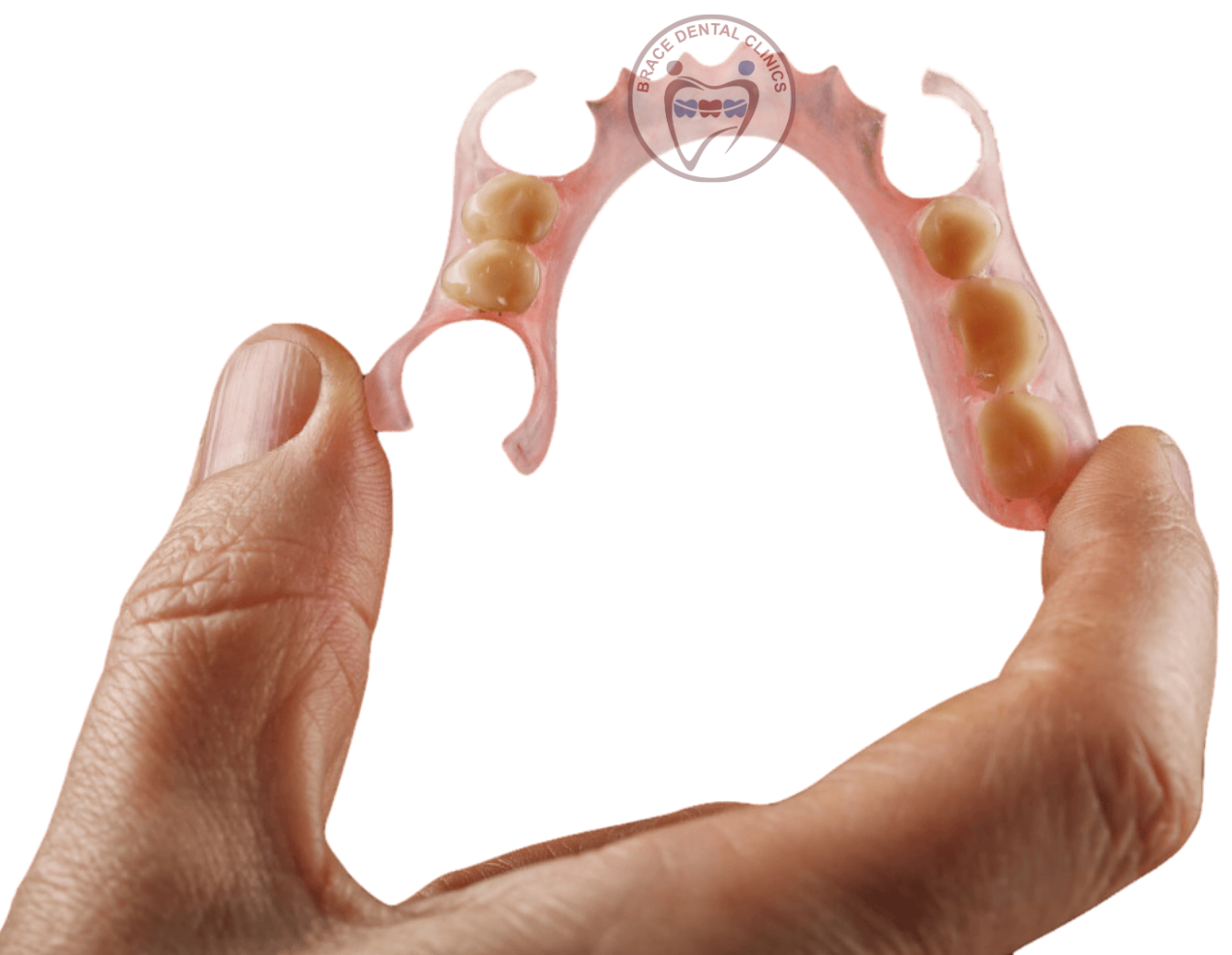 Removable Partial Denture - Brace Dental