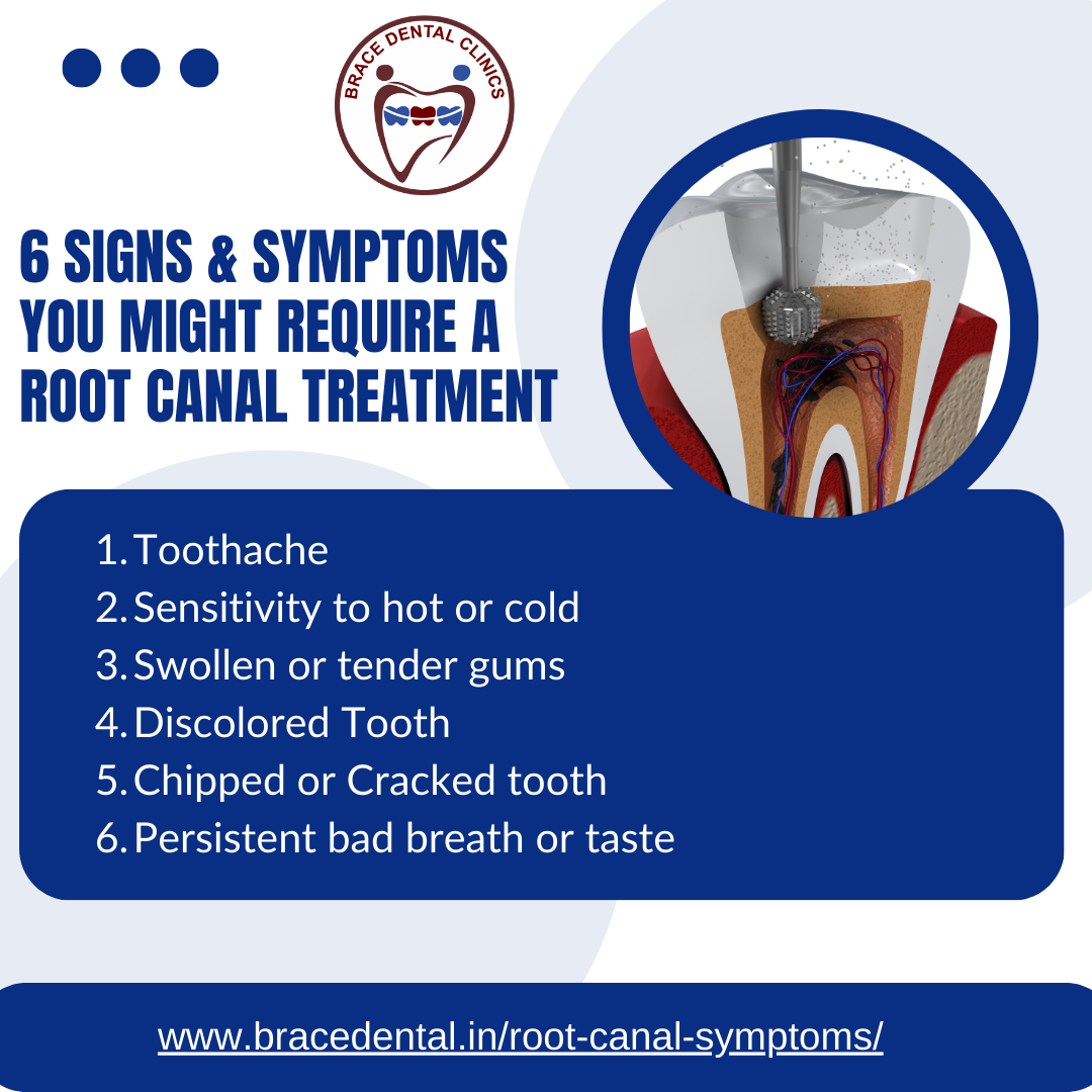 Signs You Need a Root Canal Treatment: Don’t Ignore These Symptoms ...